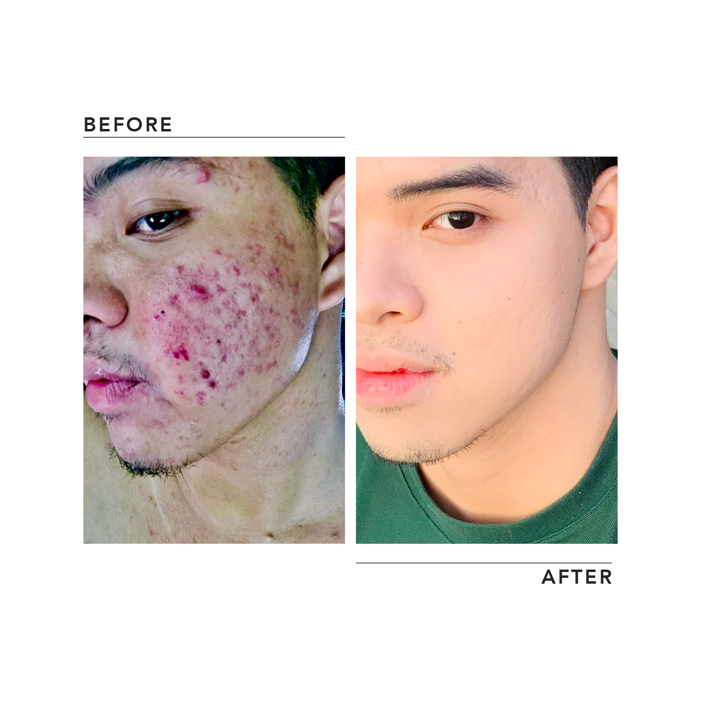 DMD Glow Program – DMD Skin Sciences